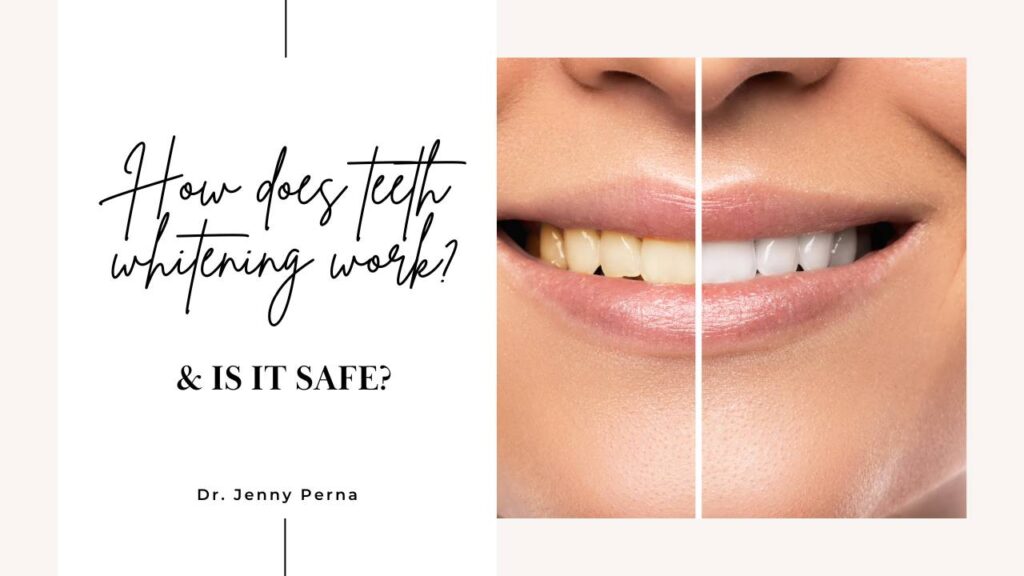 How Does Teeth Whitening Work